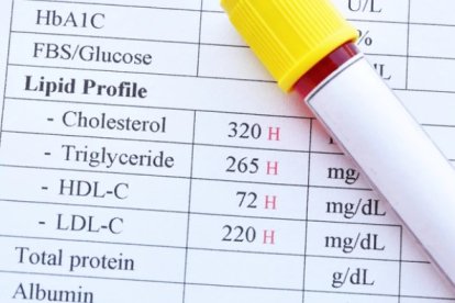 Triglicéridos: qué indican realmente cuando aparecen en un análisis ...