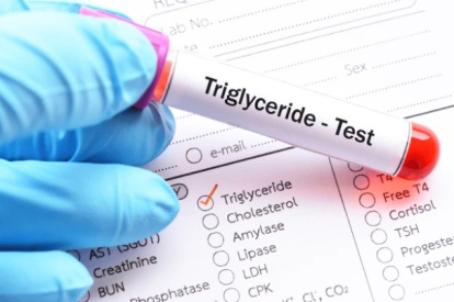 Triglicéridos: qué indican realmente cuando aparecen en un análisis ...