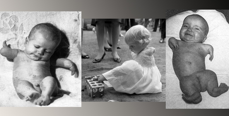 Hijos de la talidomida